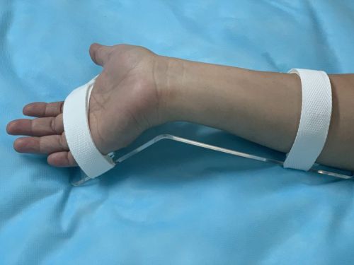Silver Stainless Steel Arterial Line Splint, For Hospital at Best Price ...